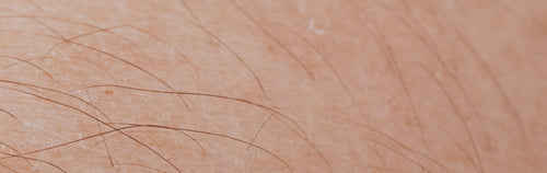 Microneedling Faqs The Most Common Questions About This Innovative Sk