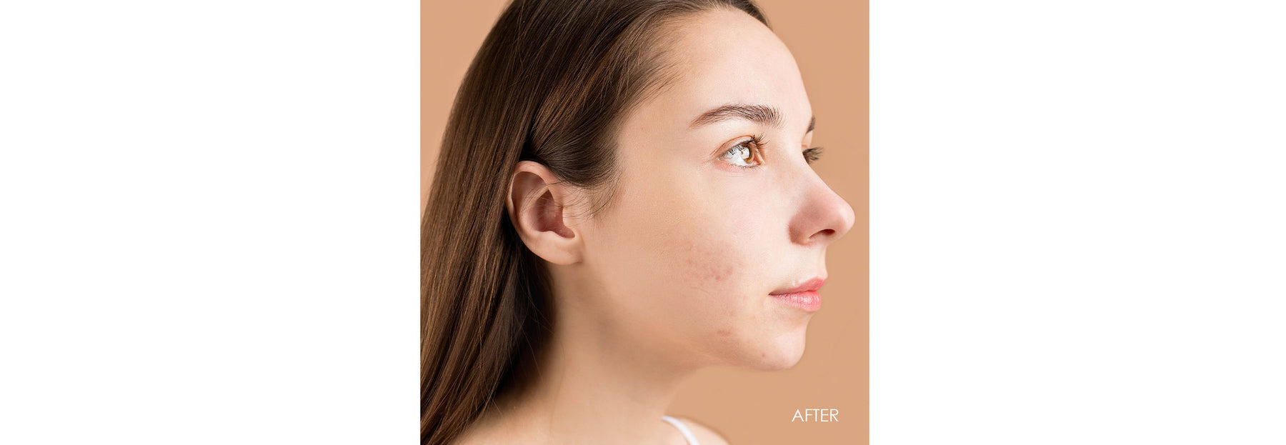 Gloa | Face and Body Cleansing Brush | Project E Beauty